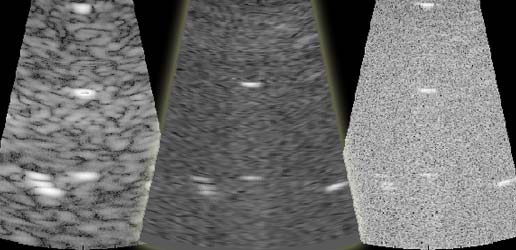 Ultrasound Imaging - Research - Yoav Schechner